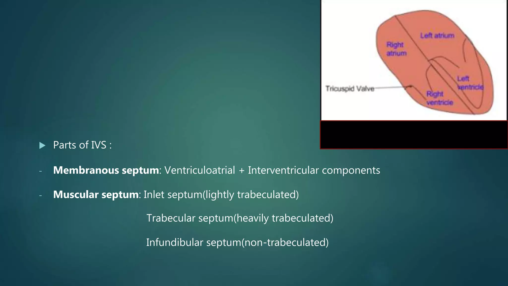 PATHOPHYSIOLOGY ,NATURAL HISTORY OF VSD | PPTX