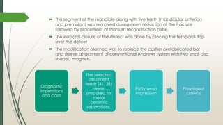 JOURNAL CLUB PRESENTATION IN PROSTHODONTICS on ANDREW'S BRIDGE SYSTEM | PPT