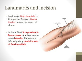 Approaches to the Elbow Joint | PPTX