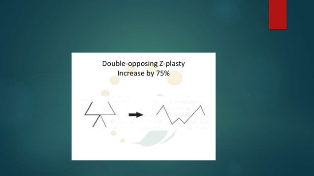 Suture techniques, Z-plasty | PPT