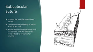 Suture techniques, Z-plasty | PPT