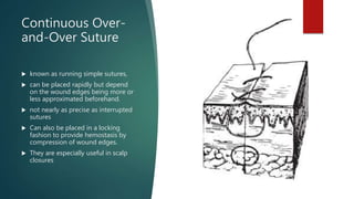 Suture techniques, Z-plasty | PPT