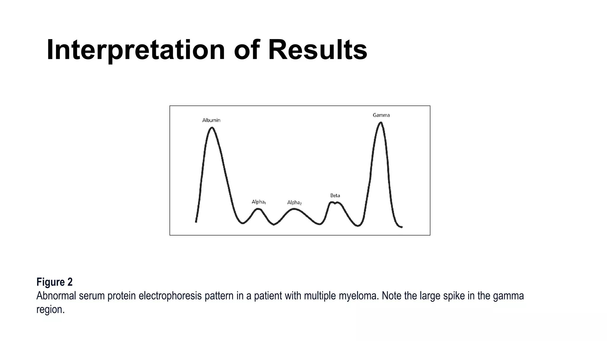 Understanding and Interpreting Serum Protein Electrophoresis | PPTX
