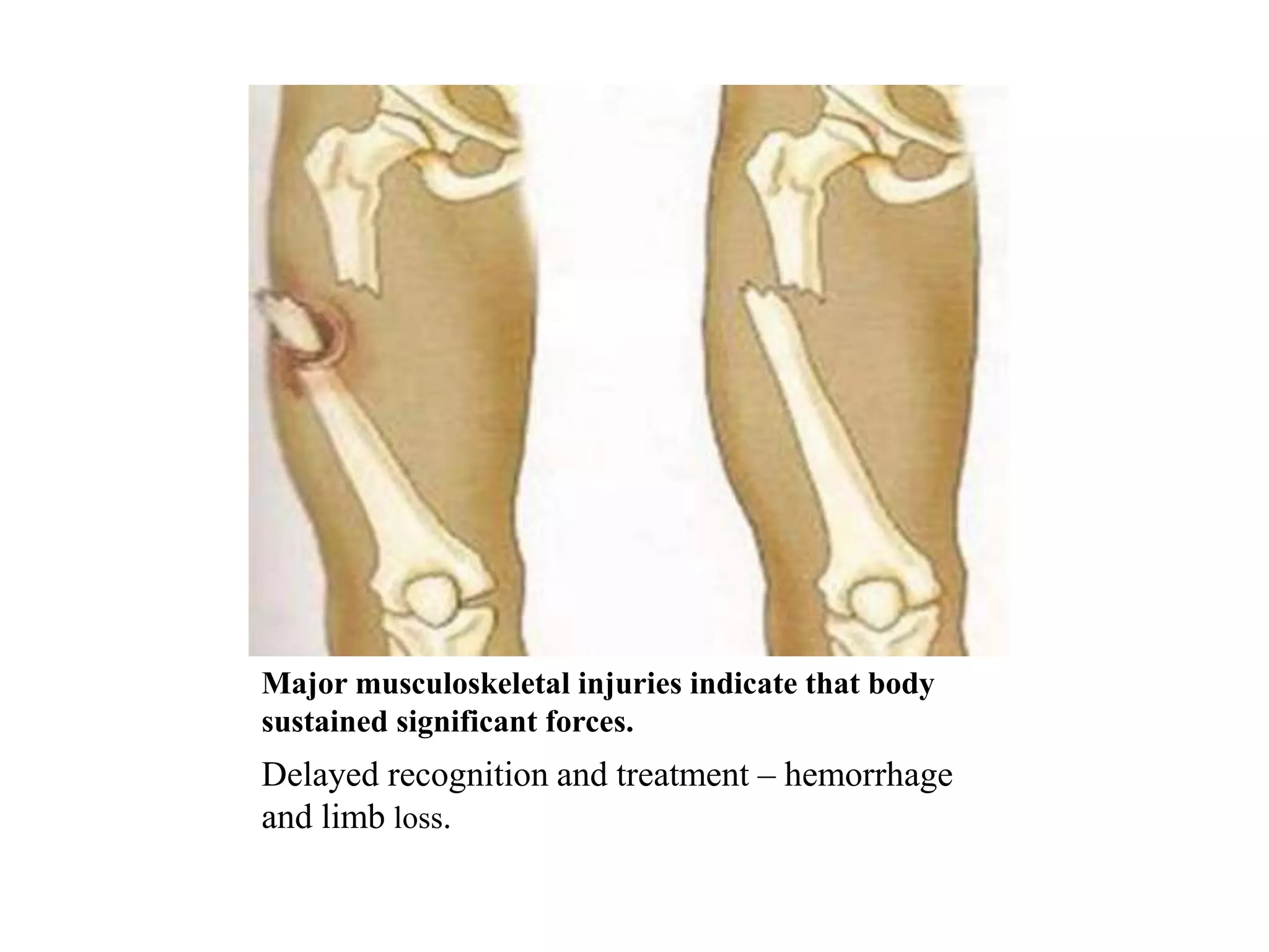 musculoskeletal trauma.pptx