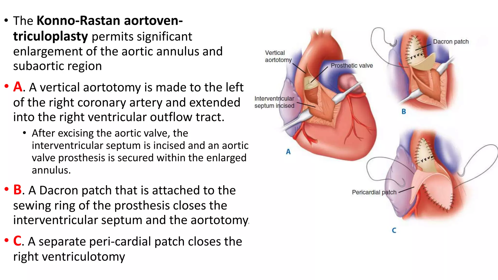 Congenital heart diseases.pptx