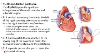 Congenital heart diseases.pptx