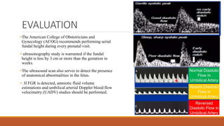 Fetal Growth Restriction.pptx