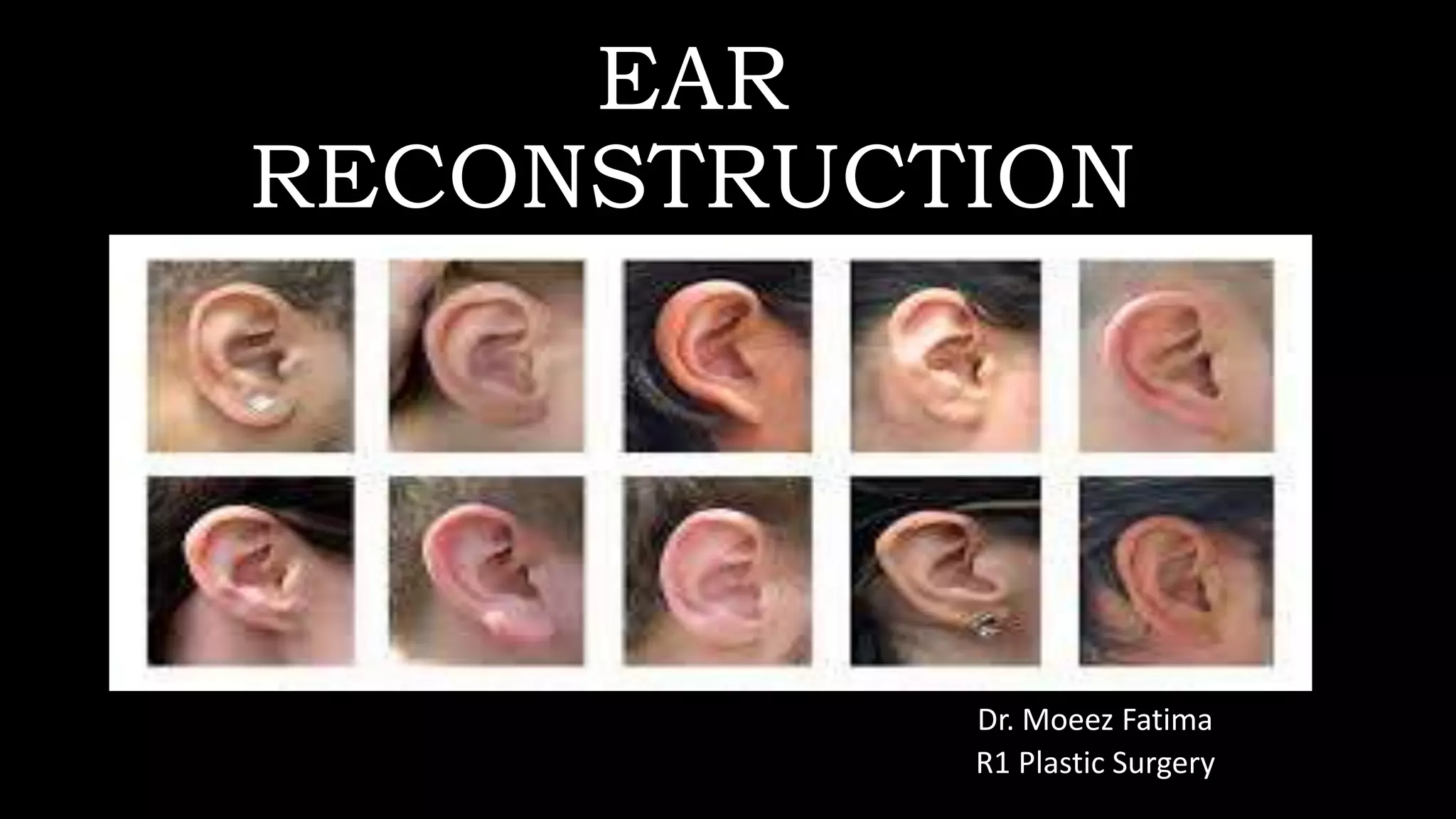 Auricular reconstruction.pptx
