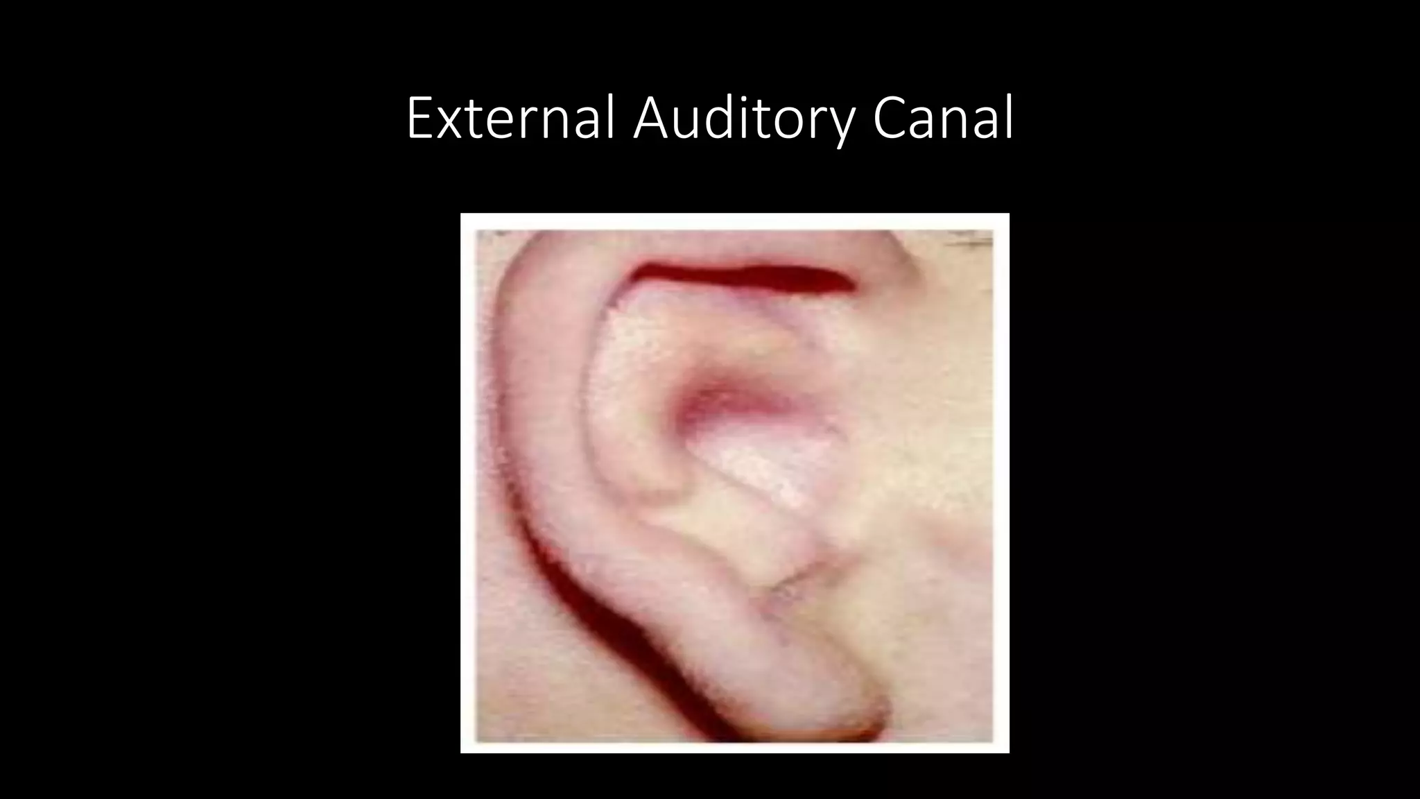 Auricular reconstruction.pptx
