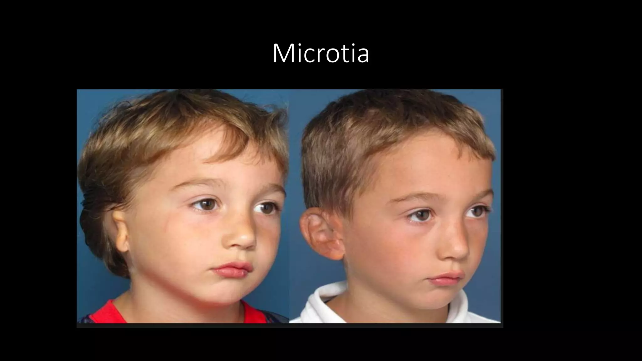 Auricular reconstruction.pptx