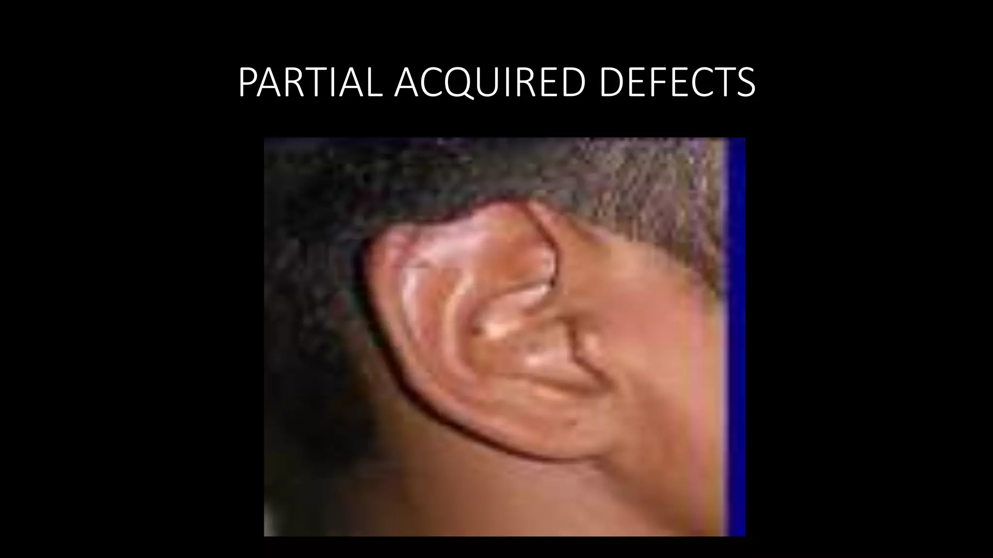 Auricular reconstruction.pptx