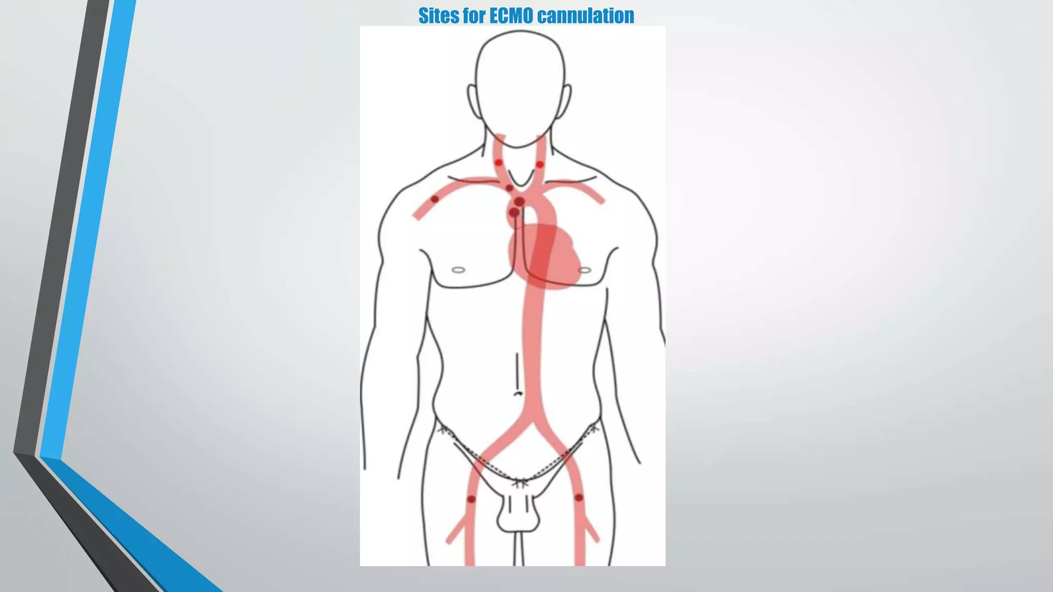 Cannulation for ECMO | PPTX