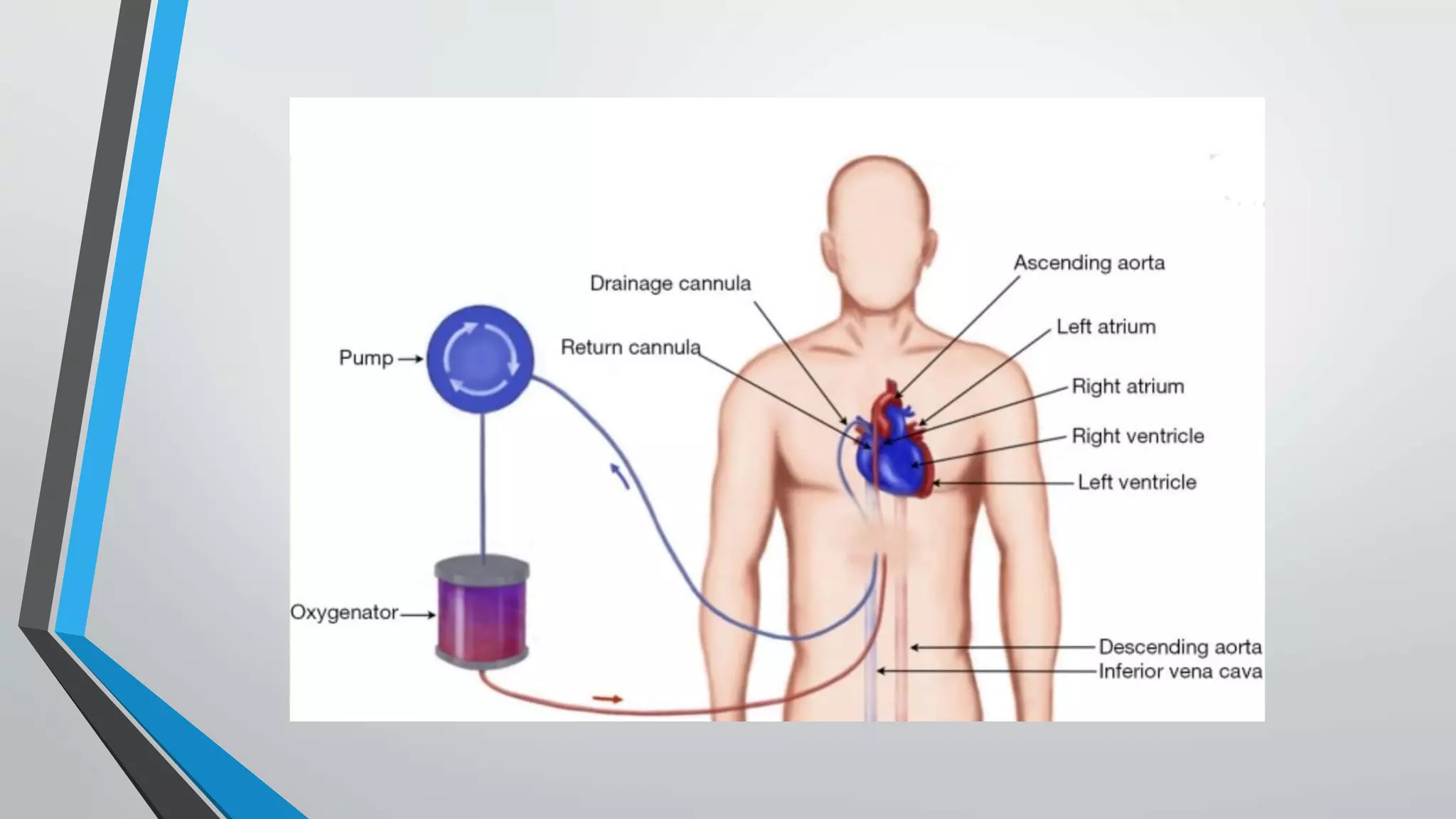 Cannulation for ECMO | PPTX