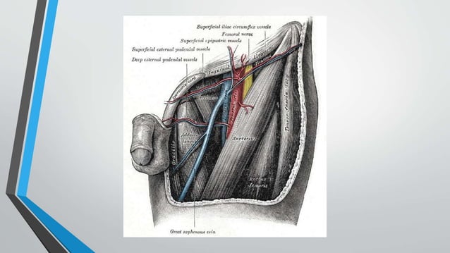 Cannulation for ECMO | PPTX
