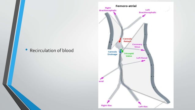 Cannulation for ECMO | PPTX