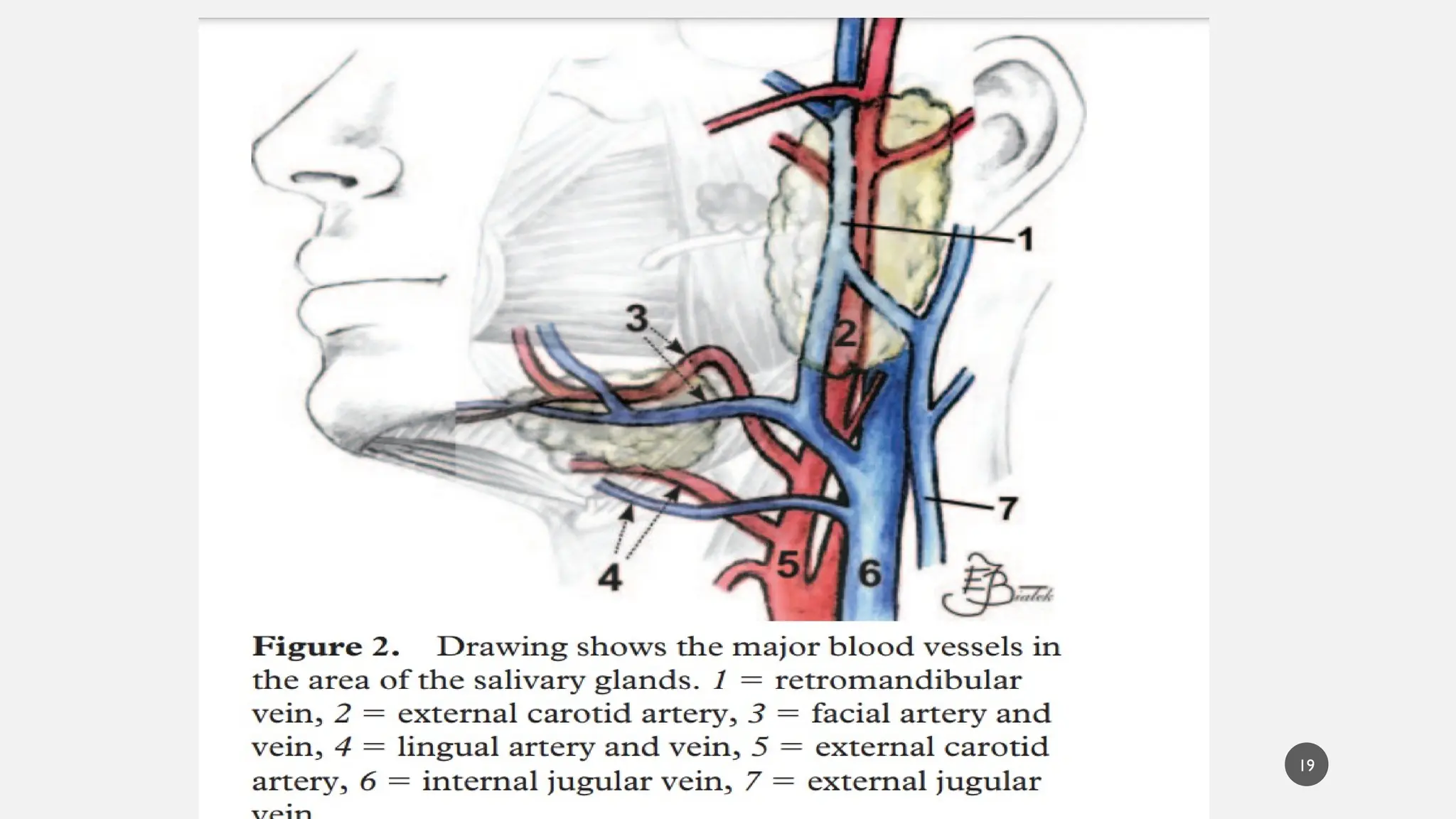 Parotid Gland Anatomy Surgical Anatomy Disease Ppt