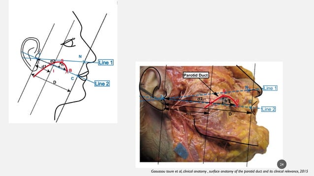 Parotid gland anatomy, surgical anatomy, disease | PPTX | Ear, Nose and ...
