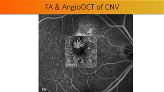 OCT angiography clinical relevance .pptx