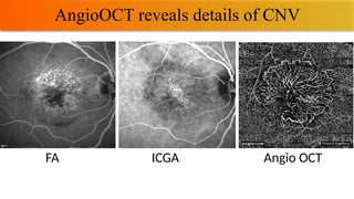 OCT angiography clinical relevance .pptx