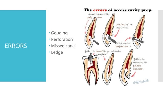 ANATOMY OF PULP AND ACCESS OPENING .pptx