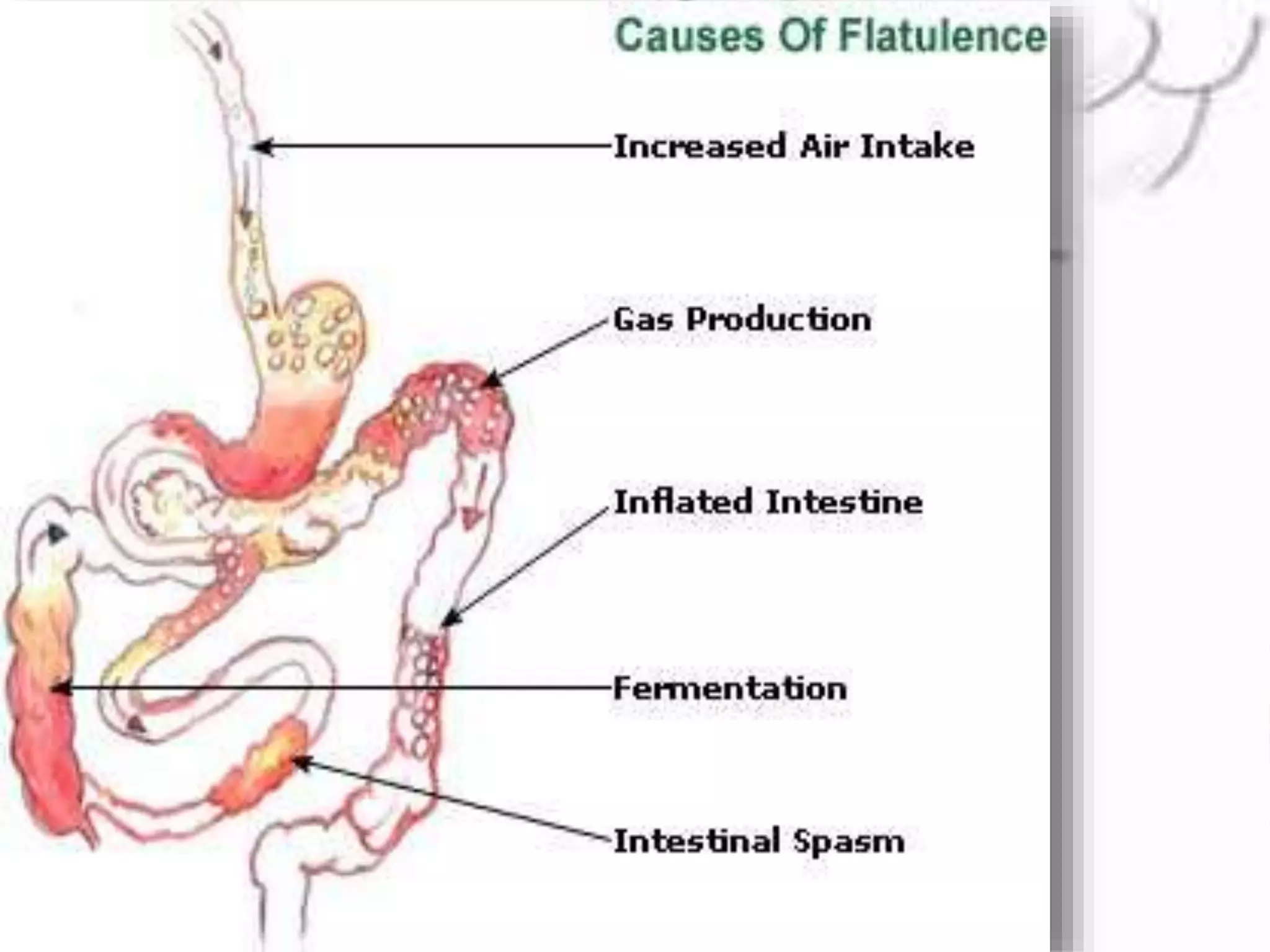 Flatulence | PPTX