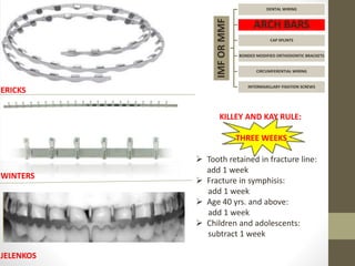 MANAGEMENT OF MAXILLOFACIAL FRACTURES | PPTX