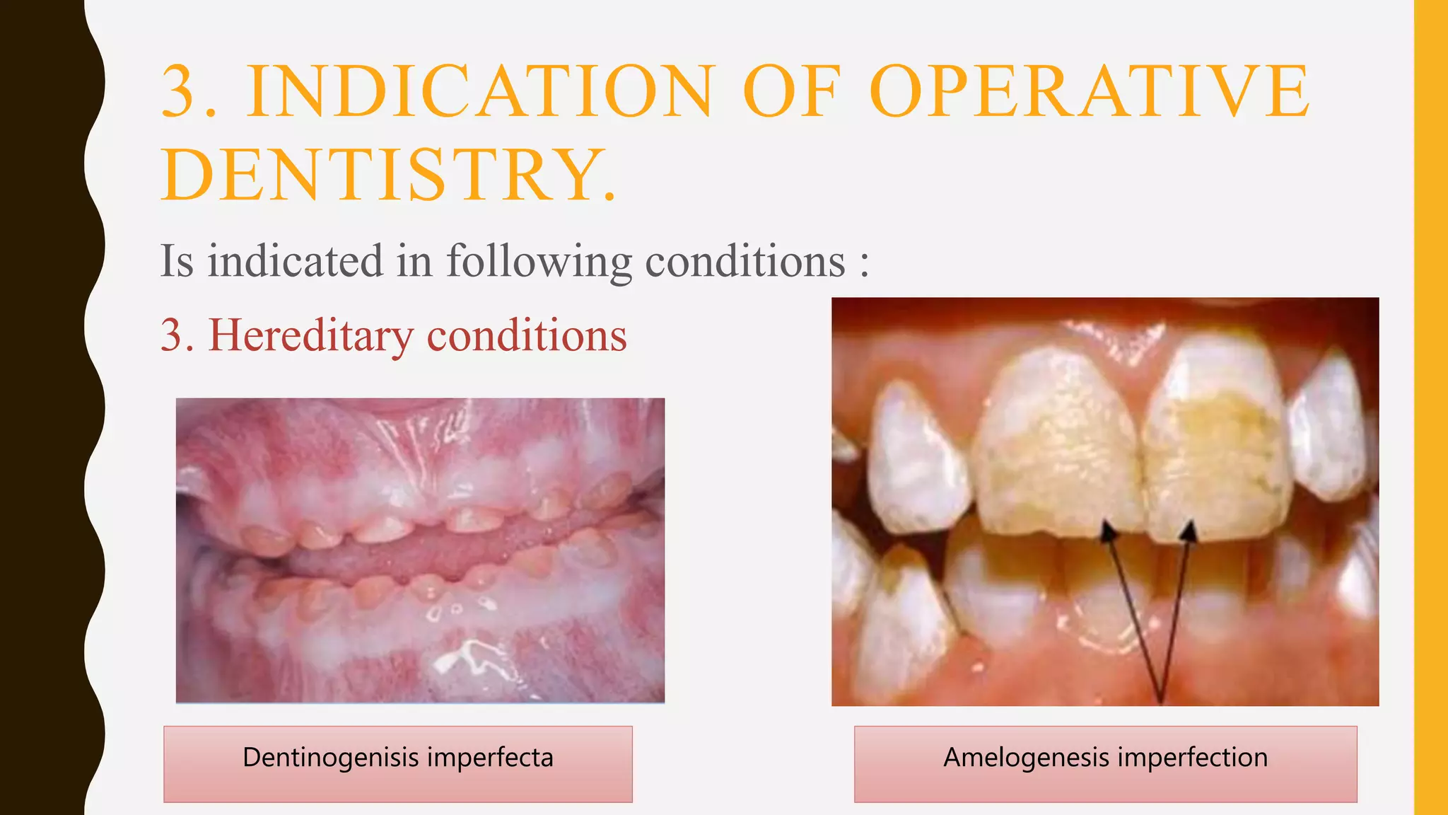 Introduction to Operative Dentistry | PPTX
