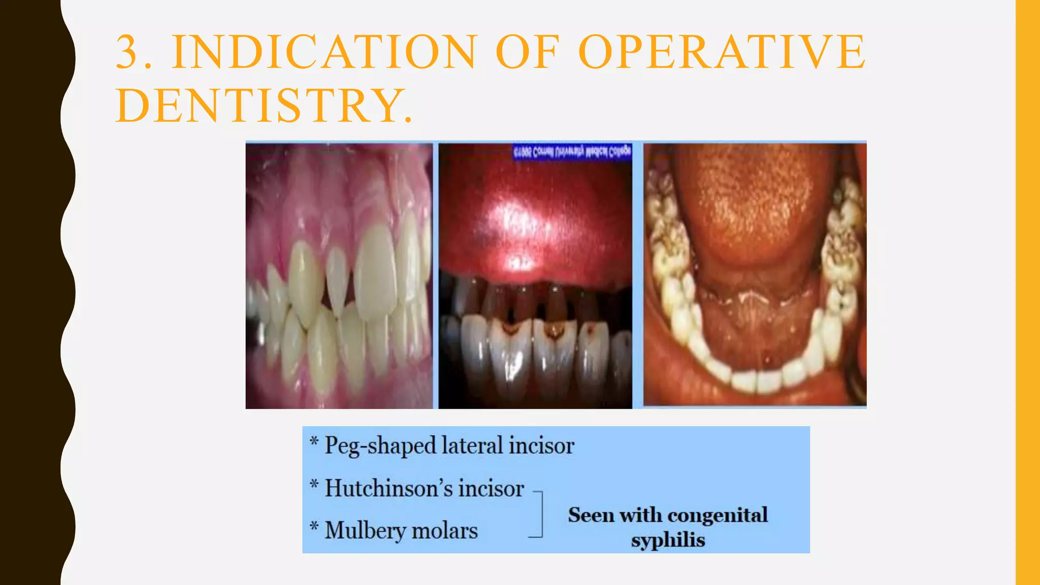 Introduction to Operative Dentistry | PPTX