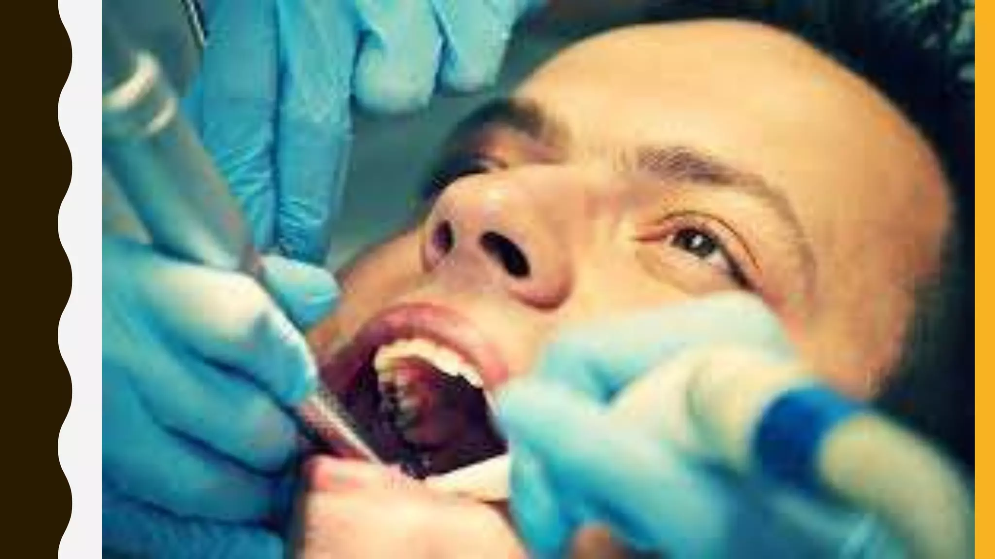 Introduction to Operative Dentistry | PPTX