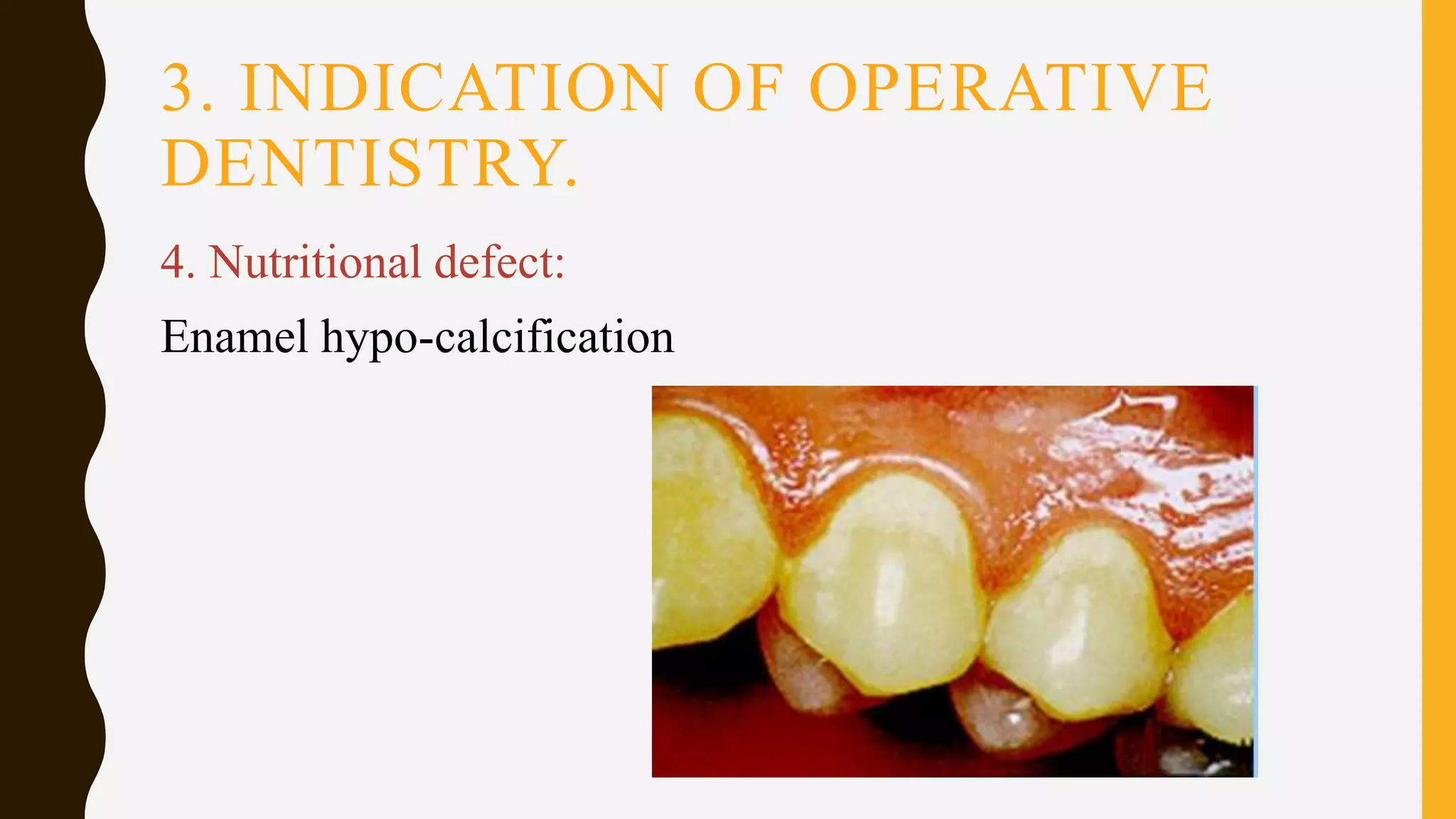 Introduction to Operative Dentistry | PPTX