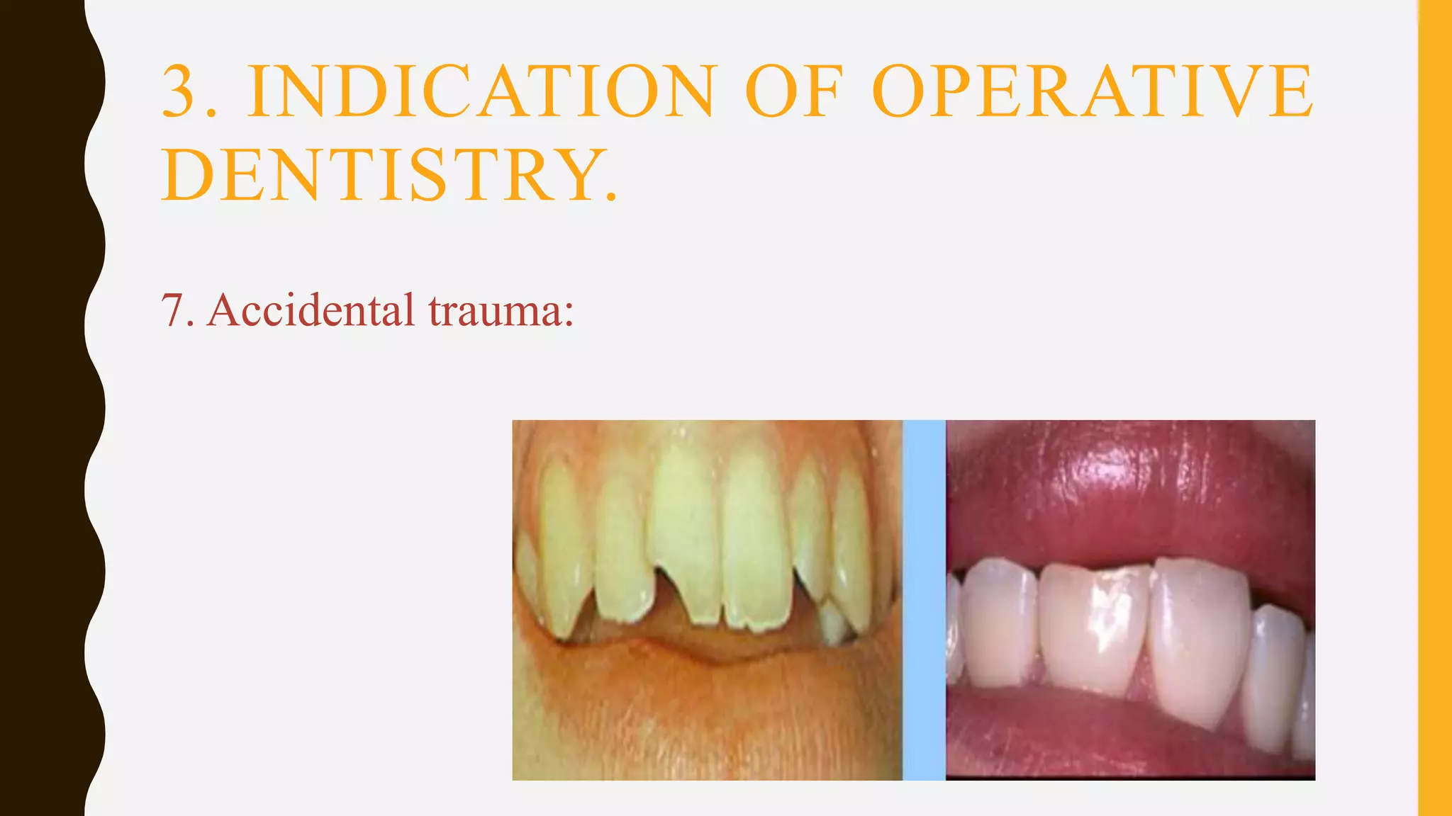 Introduction to Operative Dentistry | PPTX