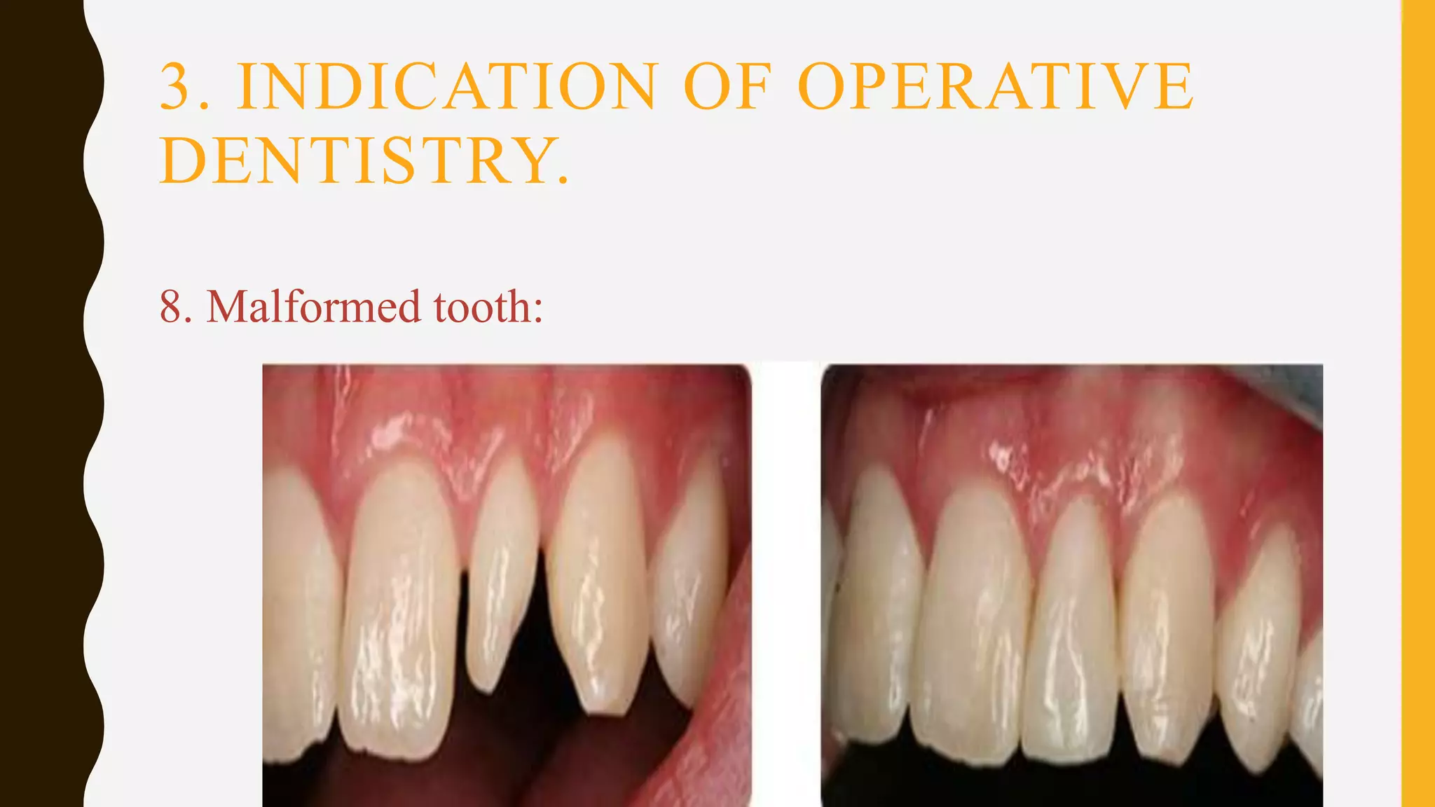 Introduction to Operative Dentistry | PPTX