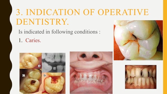 Introduction to Operative Dentistry | PPTX | Dental Health | Diseases ...
