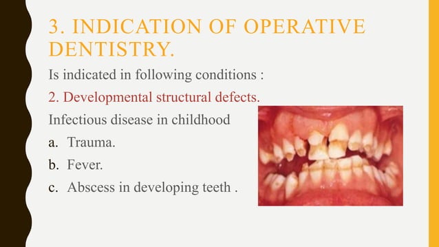 Introduction to Operative Dentistry | PPTX | Dental Health | Diseases ...