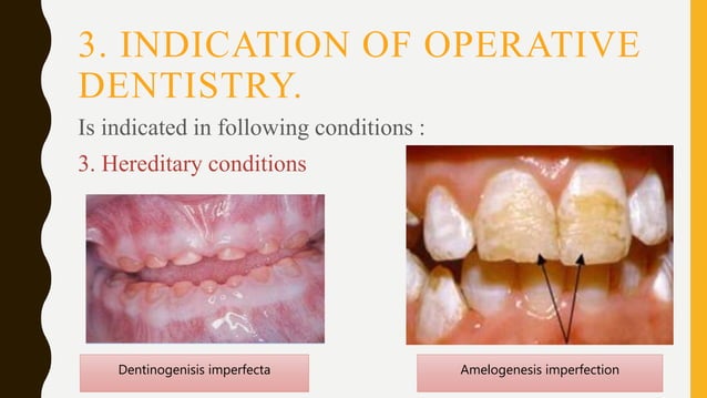 Introduction to Operative Dentistry | PPTX | Dental Health | Diseases ...
