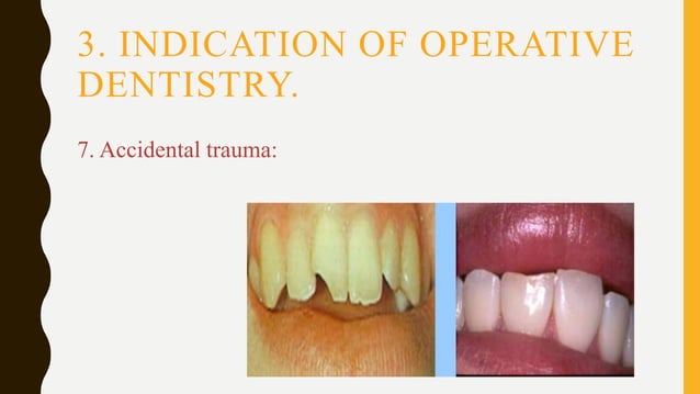 Introduction to Operative Dentistry | PPTX | Dental Health | Diseases ...