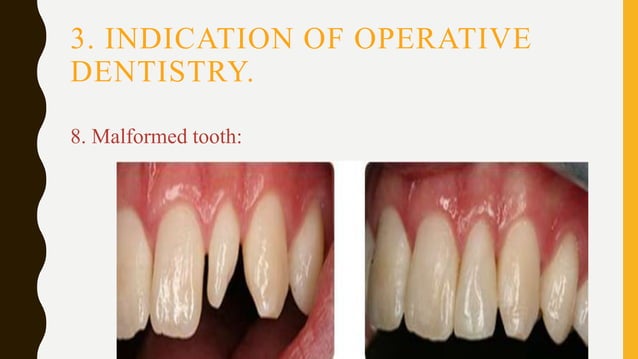 Introduction to Operative Dentistry | PPTX | Dental Health | Diseases ...