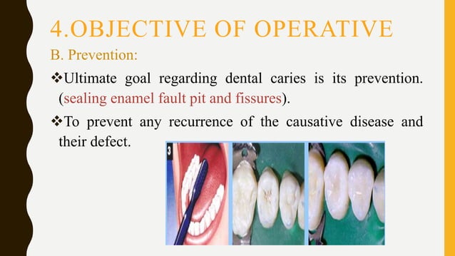 Introduction to Operative Dentistry | PPTX | Dental Health | Diseases ...