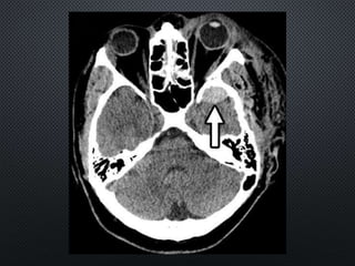 Prototype challenge presentation on model | PPT