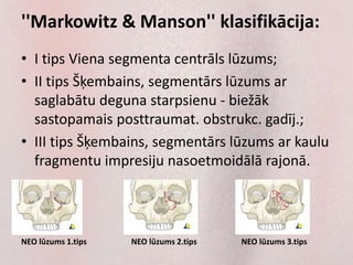Ductus nasolacrimalis traumas | PPTX