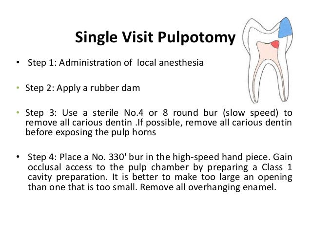 Pulpotomy