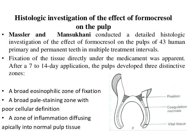 Pulpotomy