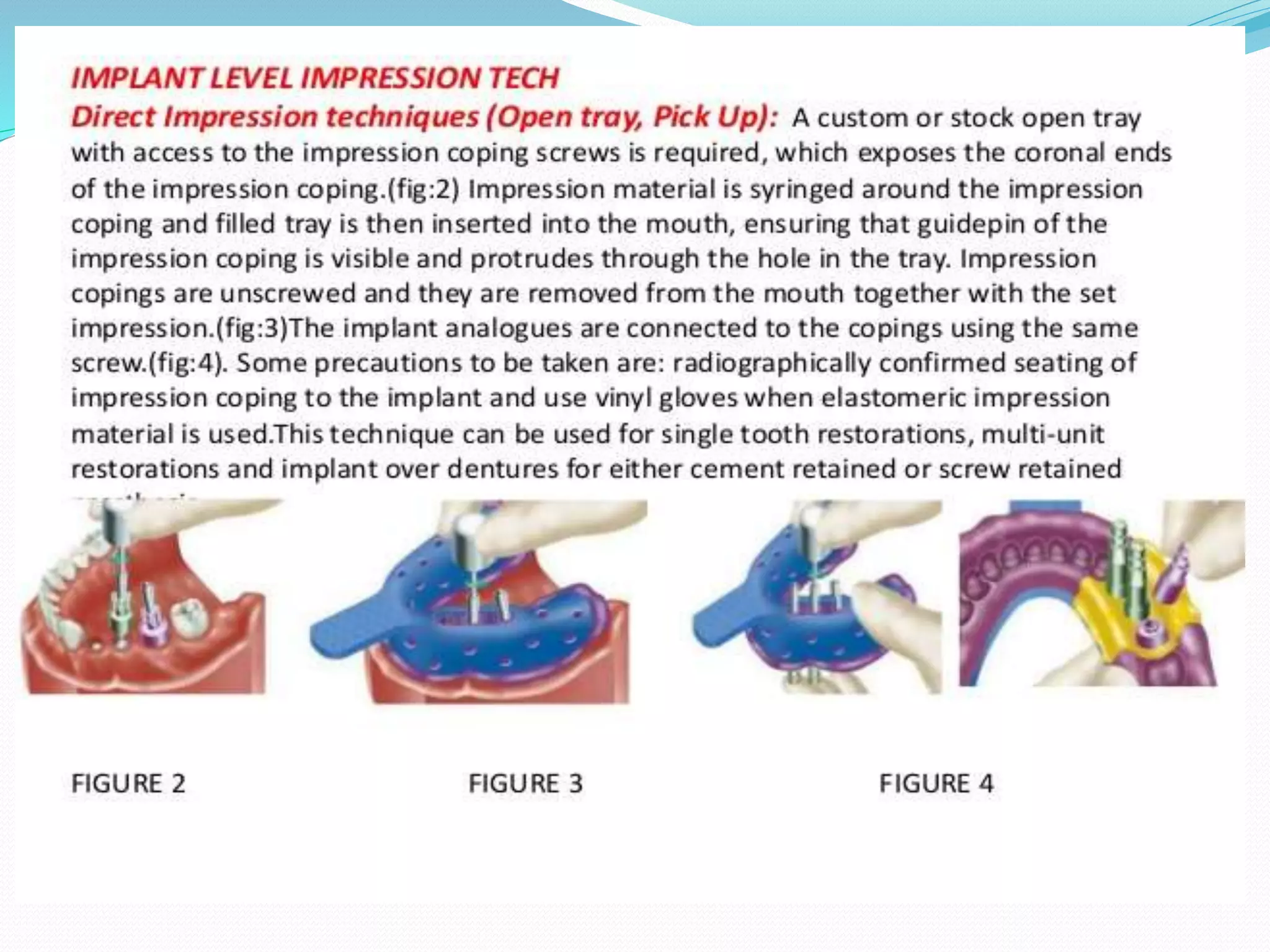 dental implant impression technique | PPTX