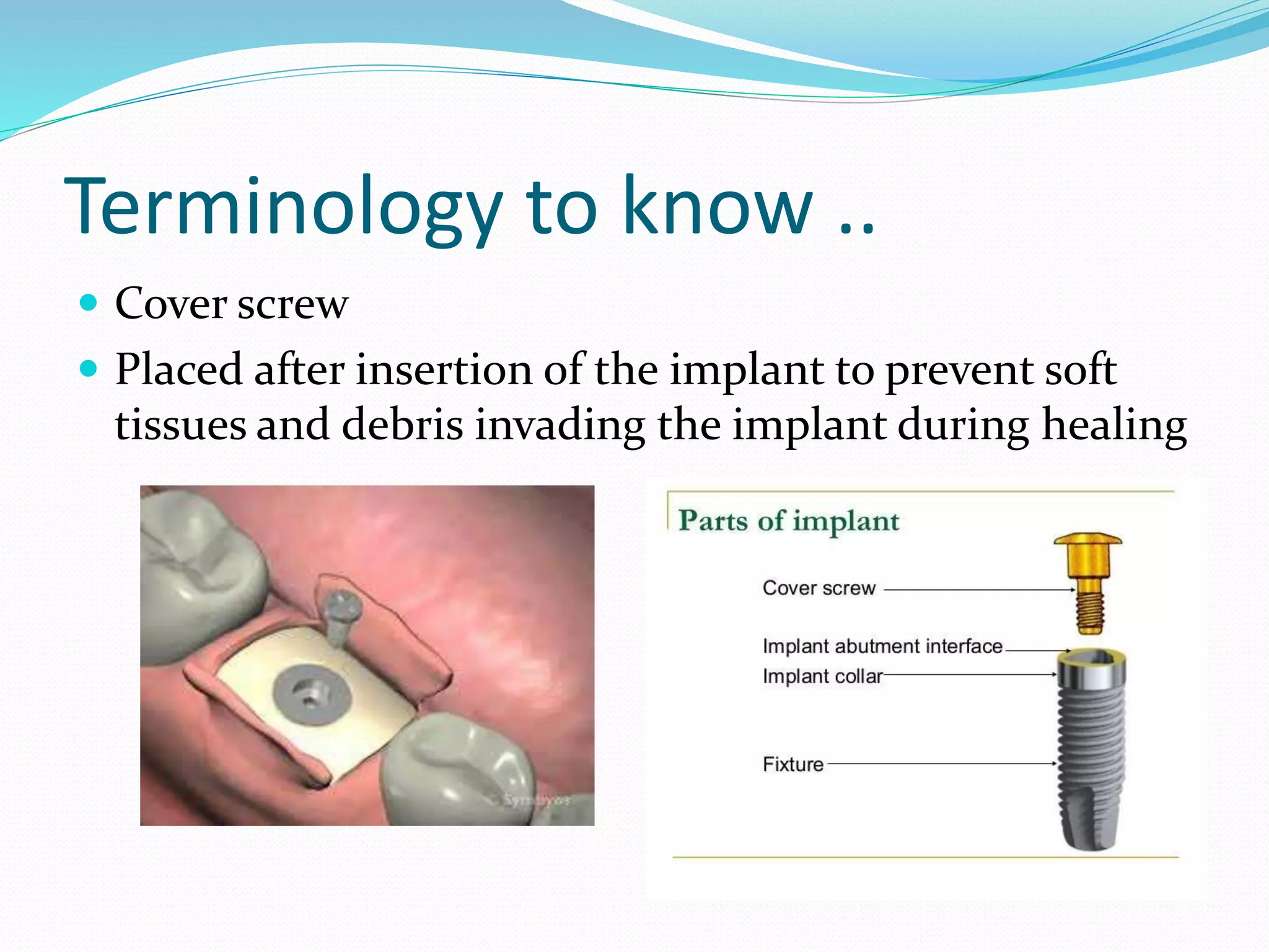 dental implant impression technique | PPTX
