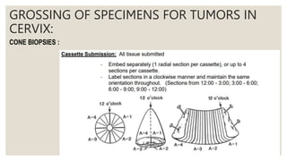 Grossing of hysterectomy specimens | PPTX