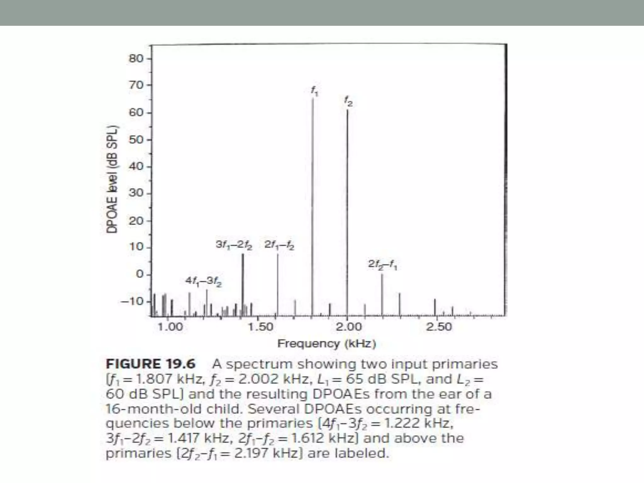 OAE and BERA ( otoacoustic emissions and brainstem evoked response ...