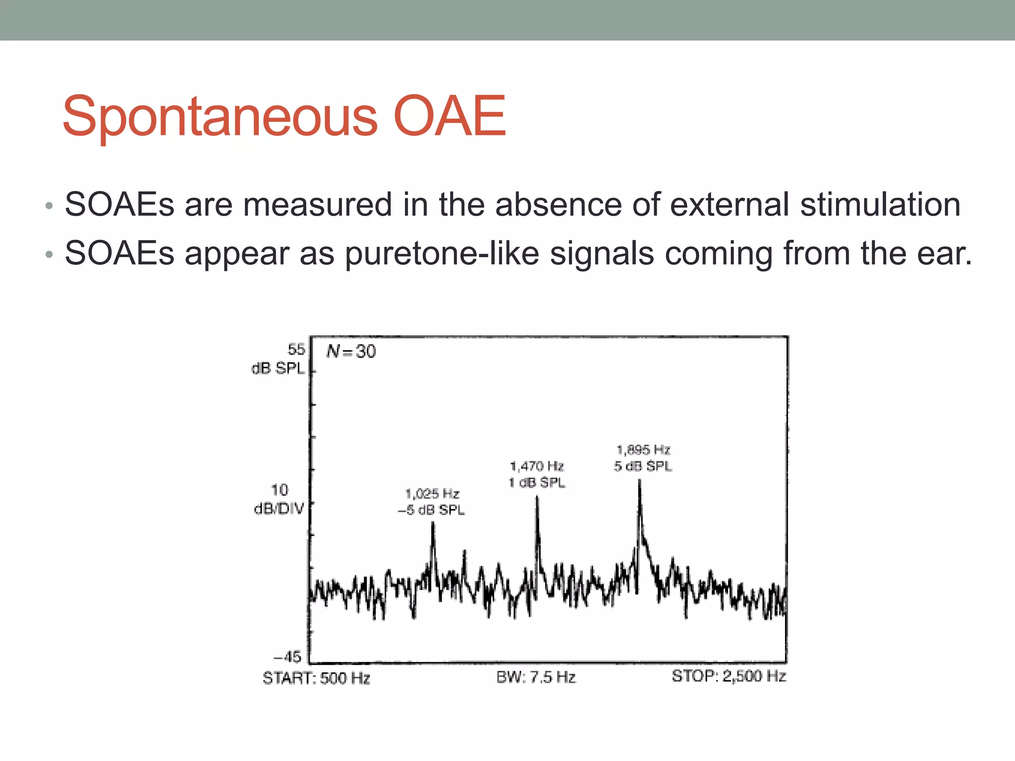 OAE and BERA ( otoacoustic emissions and brainstem evoked response ...