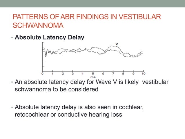 OAE and BERA ( otoacoustic emissions and brainstem evoked response ...