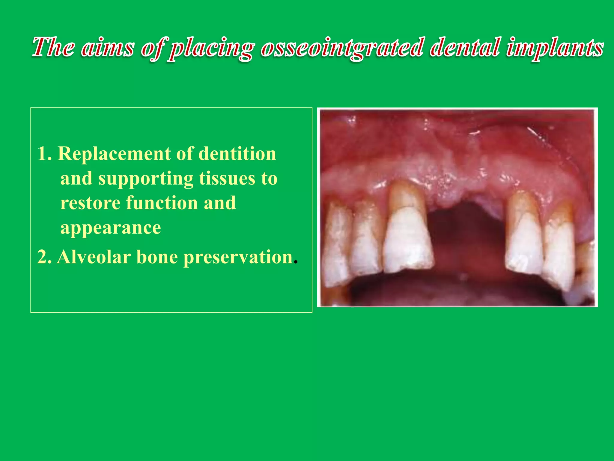 implant supported fixed restorations | PPTX