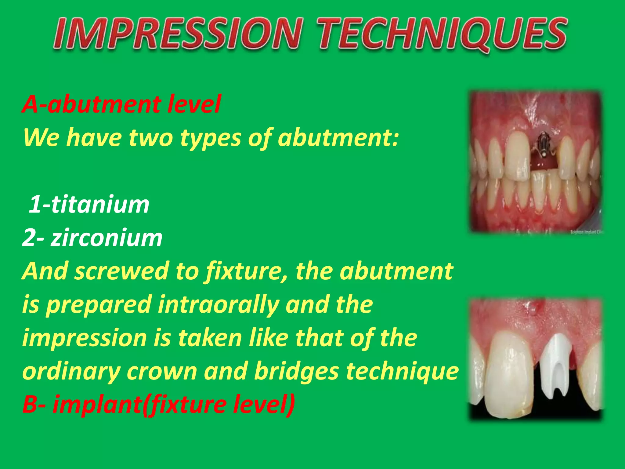 implant supported fixed restorations | PPTX